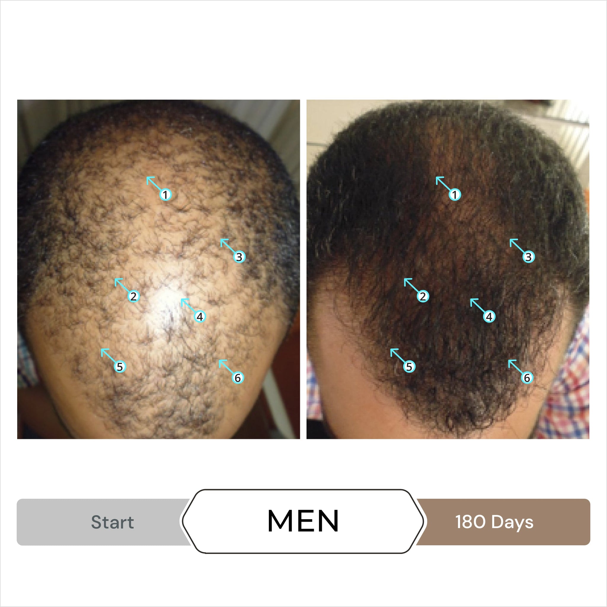 Spectral Dnc N Redensifying Serum With Nanoxidil® 5 Ds